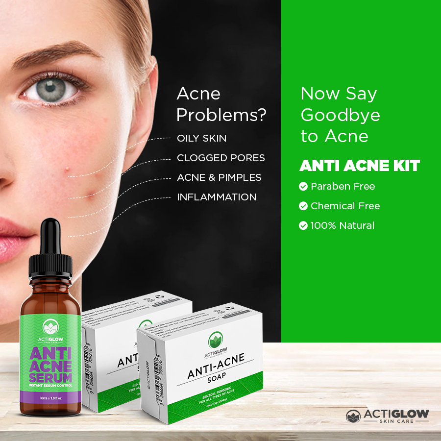 Anti Acne Kit – actiglow